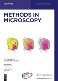 Operando XCT with fine sampling of discharge process provides new ...