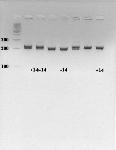 Impact of HLA-G 14 bp polymorphism and soluble HLA-G level on kidney graft outcome