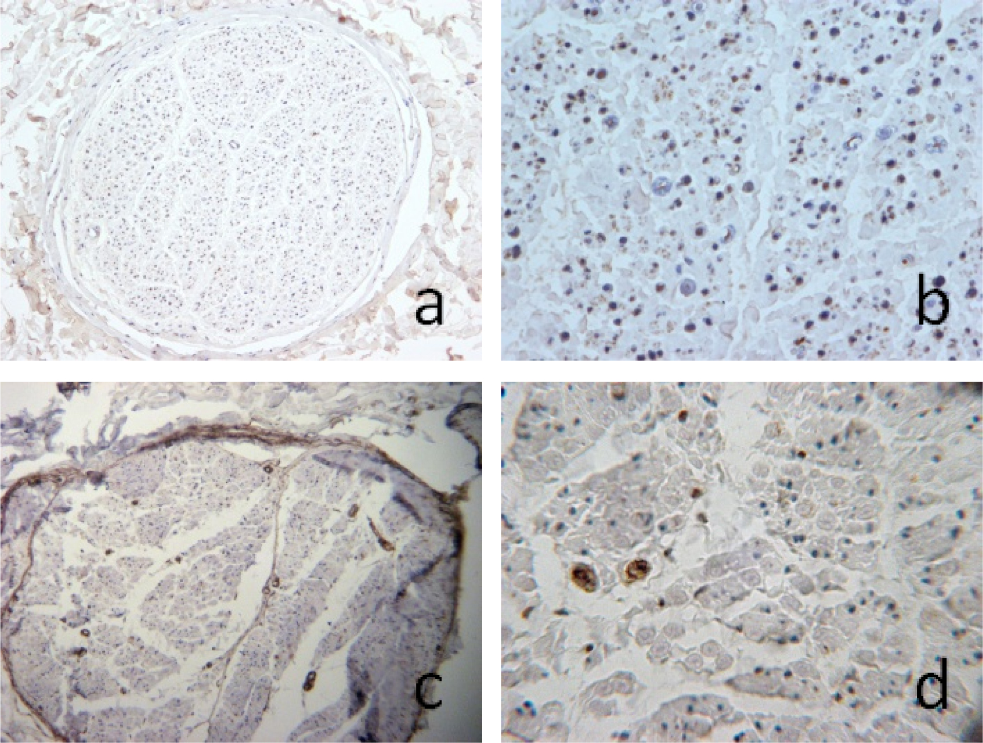 Association between Caveolin-1 expression and pathophysiological ...