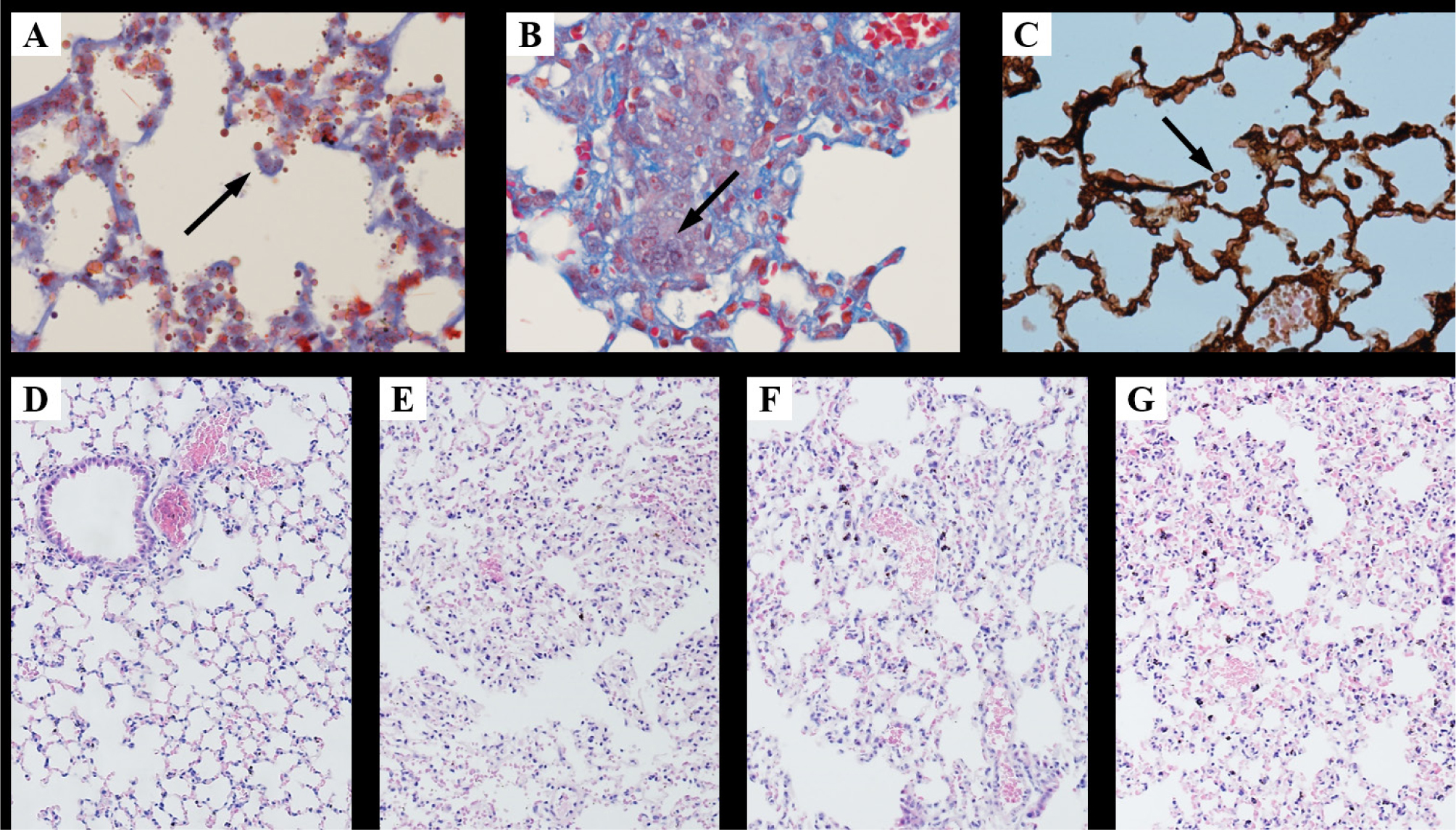 mTOR modulates CD8+ T cell differentiation in mice with invasive ...