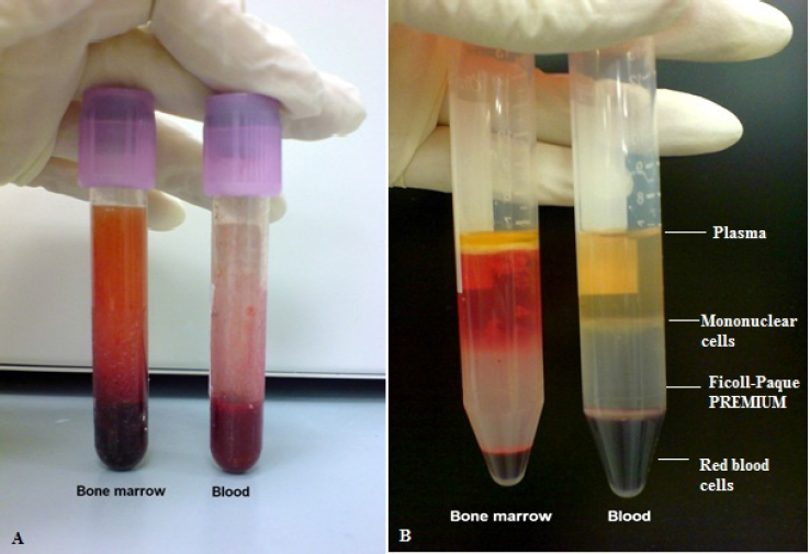 Factors Influencing the Successful Isolation and Expansion of Aging ...