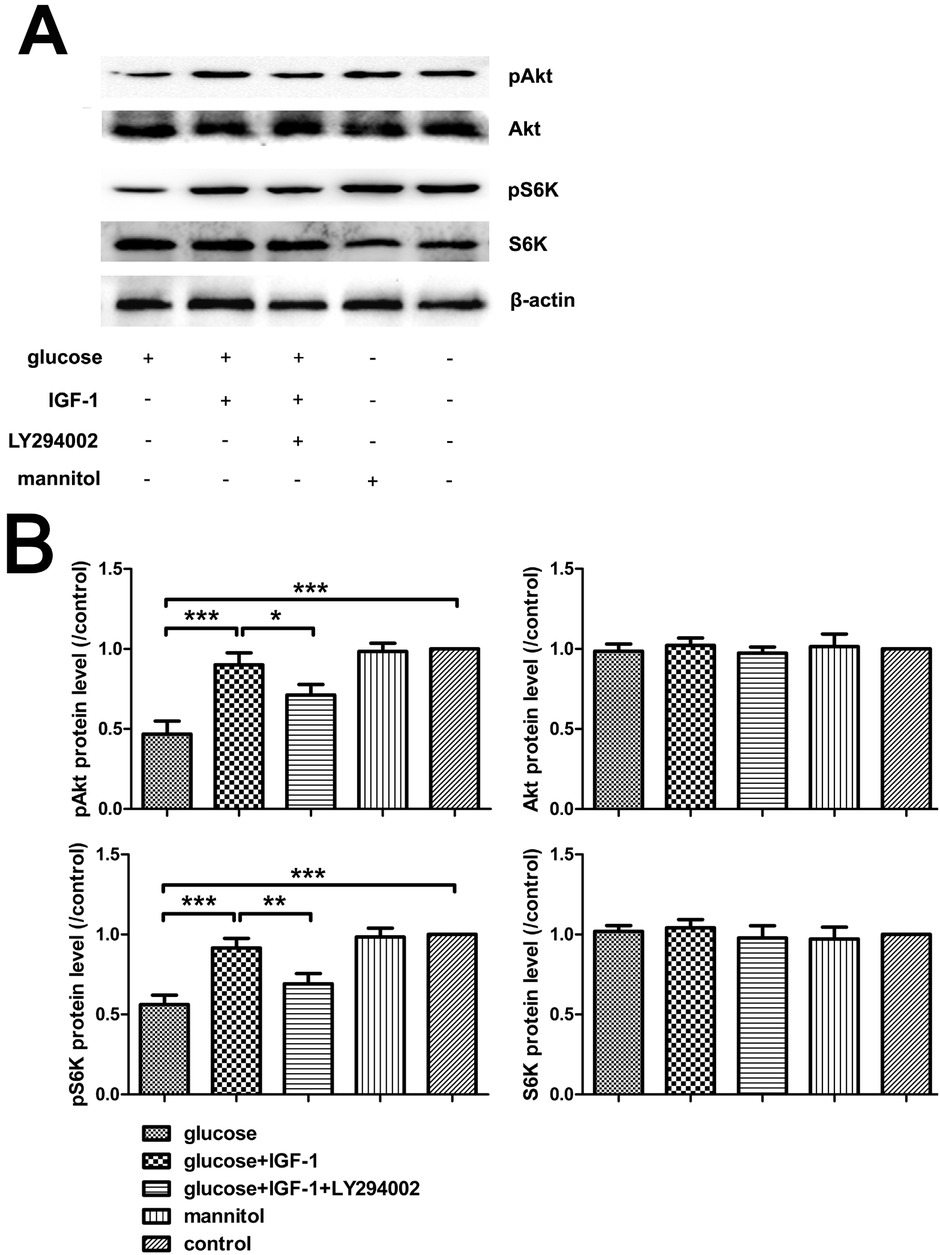 IGF-1 via PI3K/Akt/S6K signaling pathway protects DRG neurons with high ...