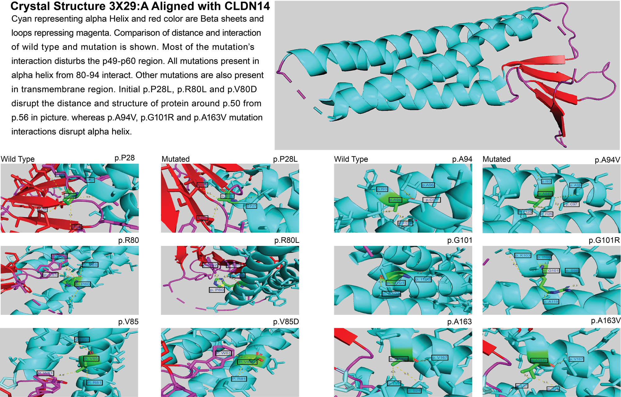 Association study of CLDN14 variations in patients with kidney stones