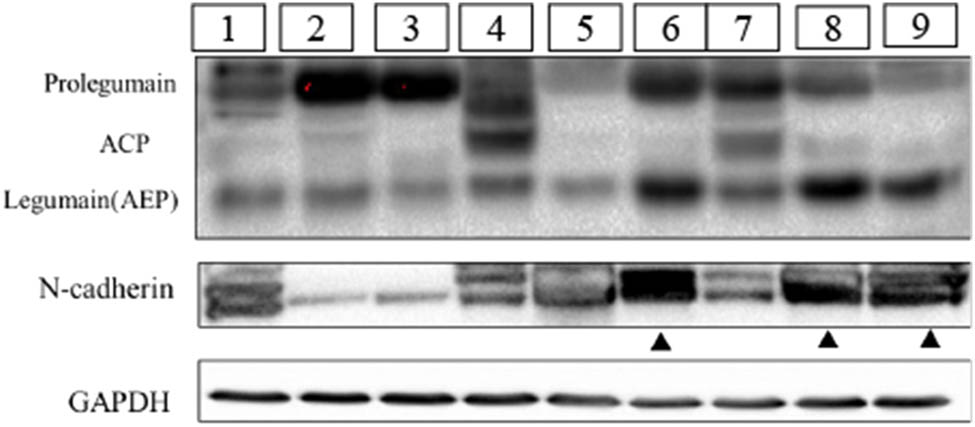 Active legumain promotes invasion and migration of neuroblastoma by ...