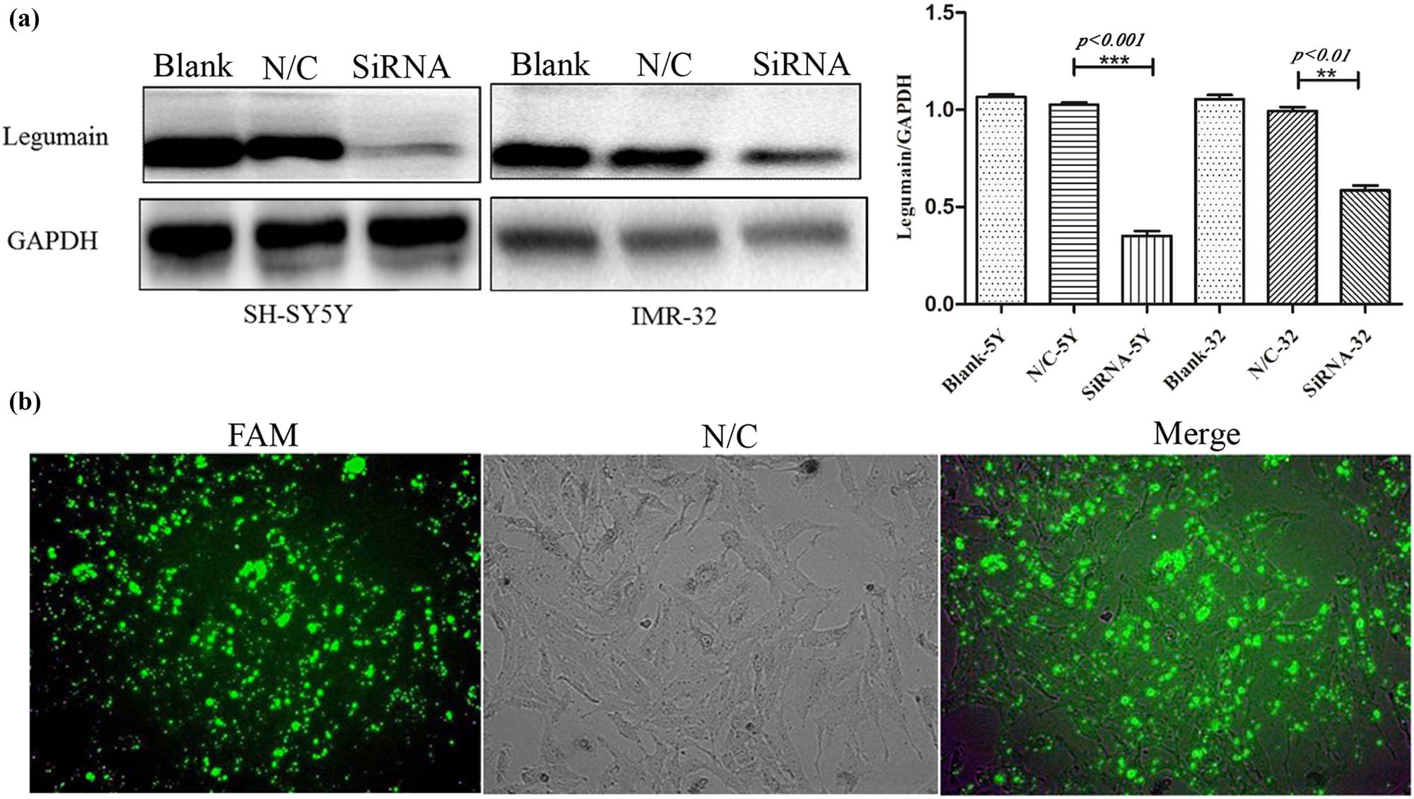 Active legumain promotes invasion and migration of neuroblastoma by ...