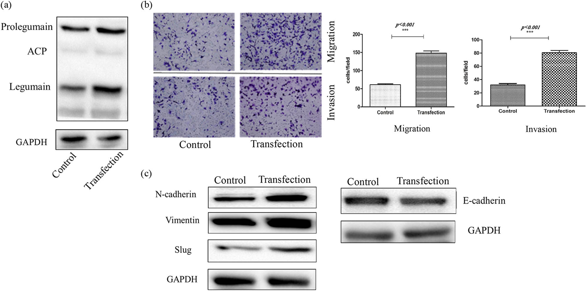 Active legumain promotes invasion and migration of neuroblastoma by ...