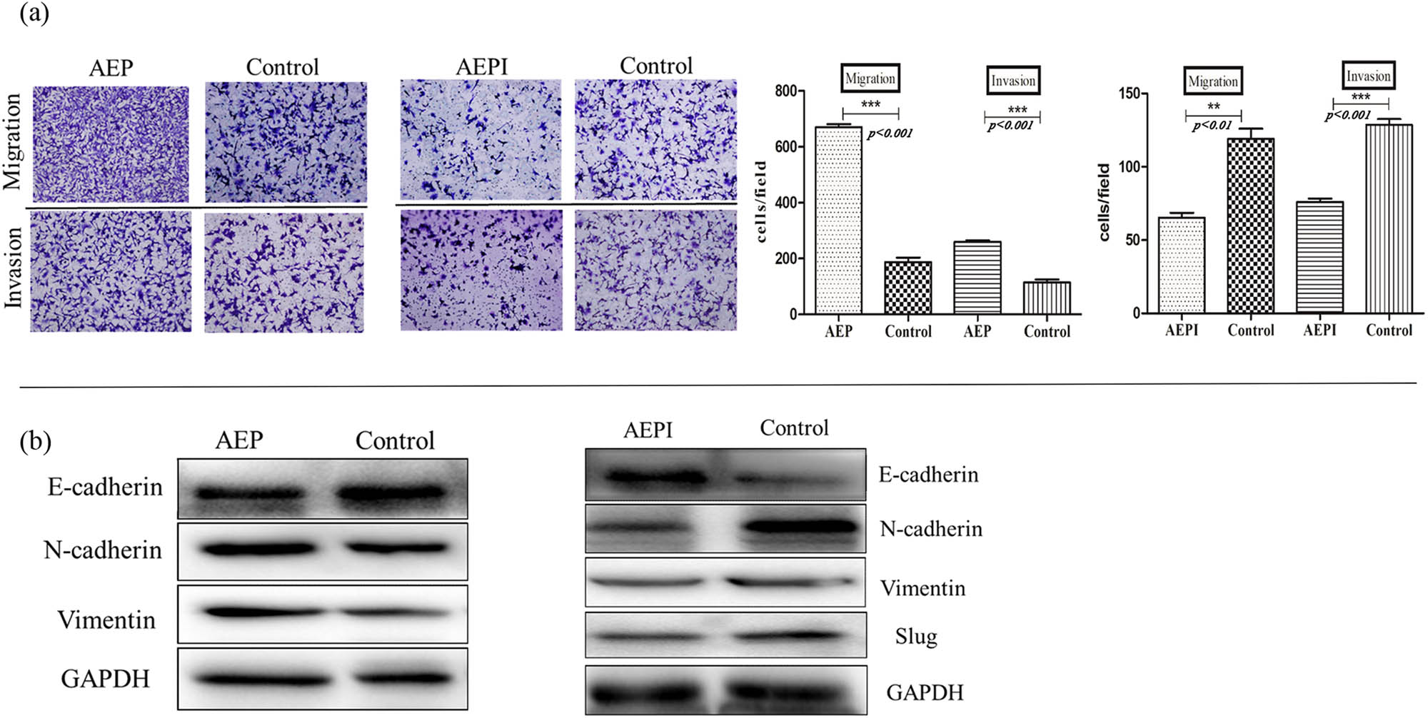 Active legumain promotes invasion and migration of neuroblastoma by ...