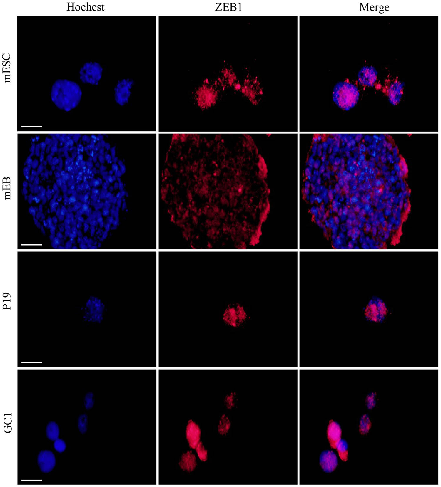 Expression of Zeb1 in the differentiation of mouse embryo...