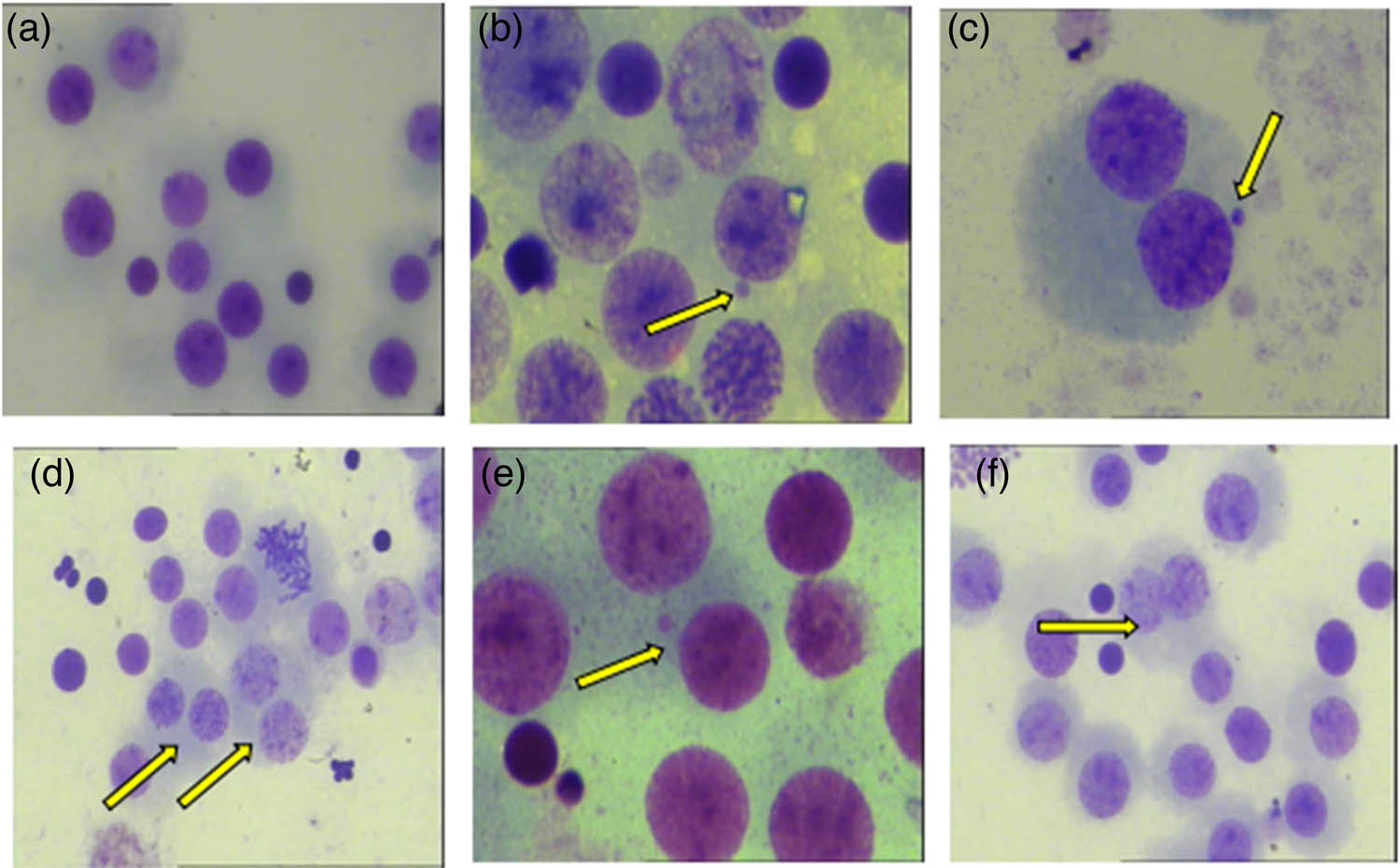 Study on the genetic damage caused by cadmium sulfide quantum dots in ...