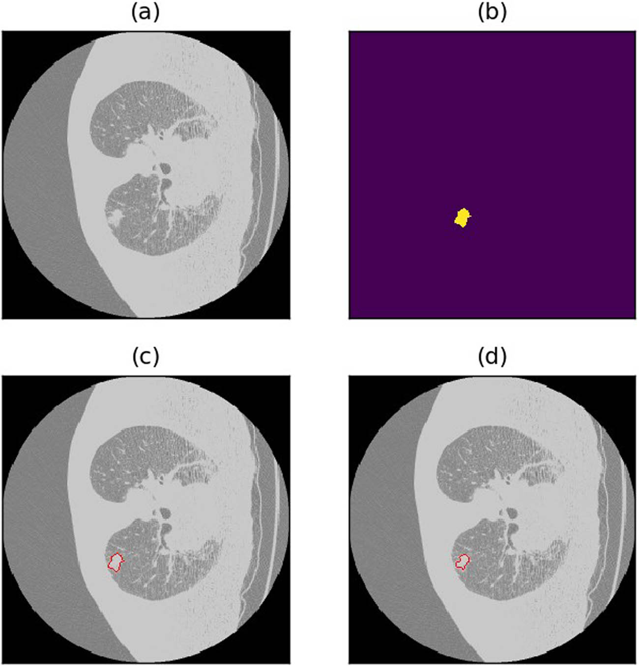 Lung nodule segmentation via semi-residual multi-resolution neural networks