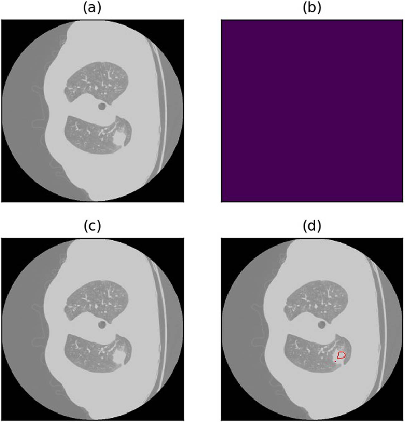 Lung nodule segmentation via semi-residual multi-resoluti...