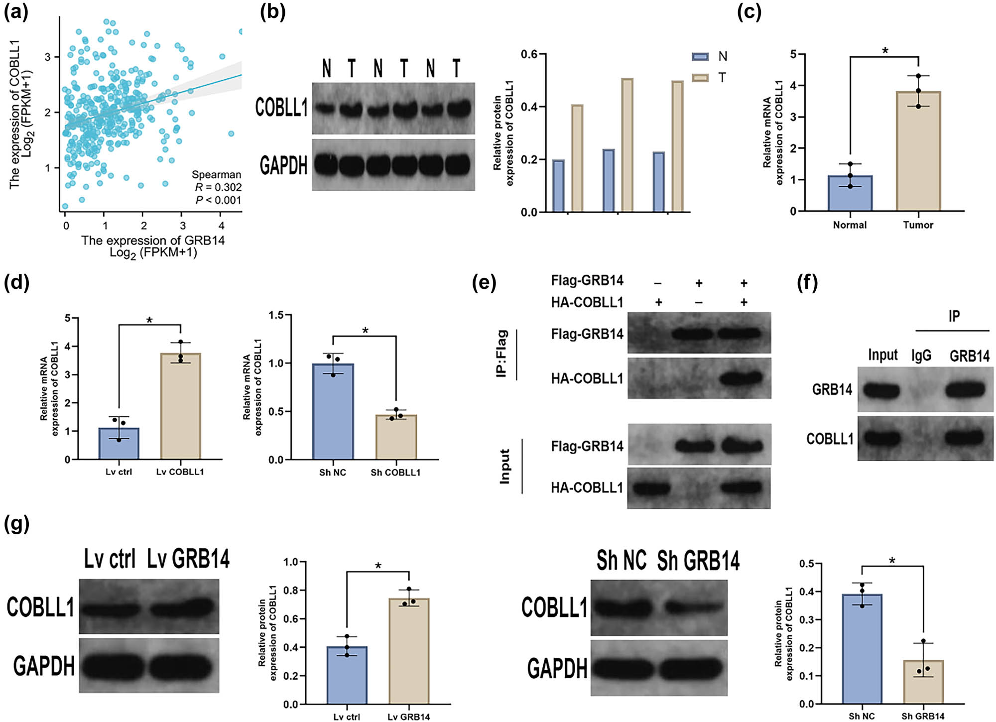 GRB14: A prognostic biomarker driving tumor progression i...