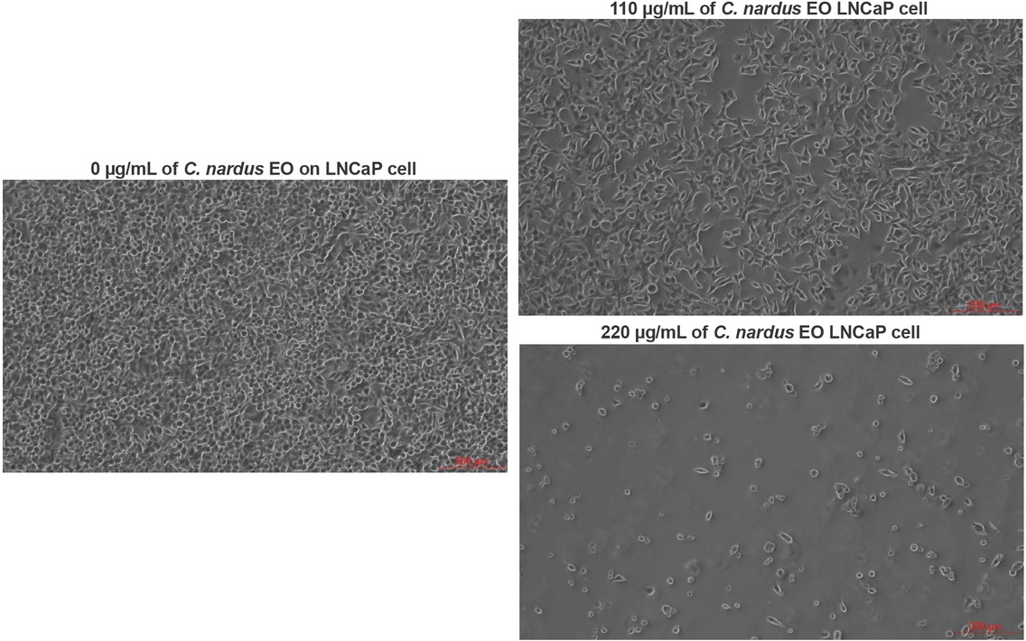Chemical composition, antioxidant, anti-inflammatory and ...