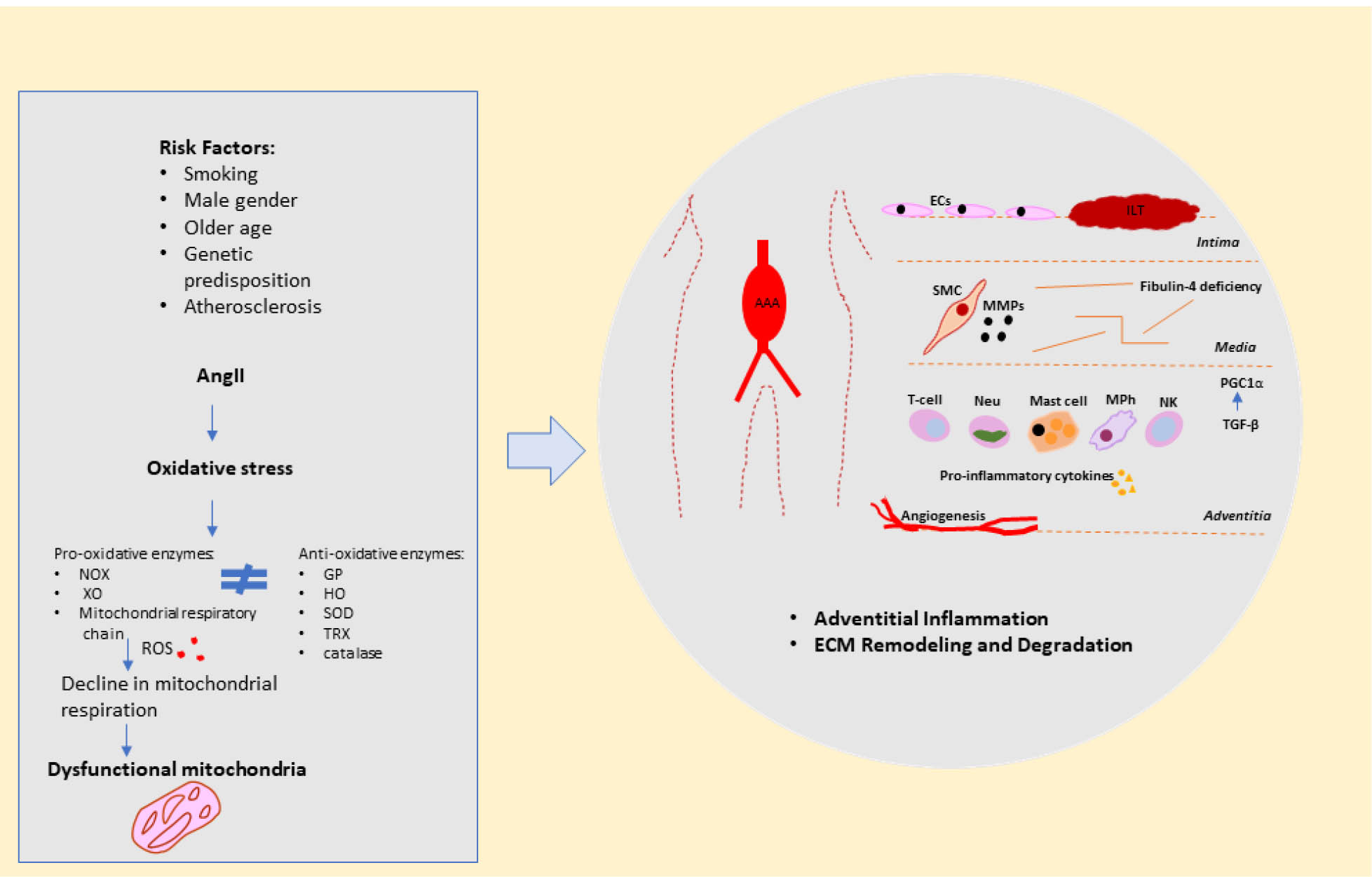 Pathophysiological Aspects of the Development of Abdominal Aortic ...