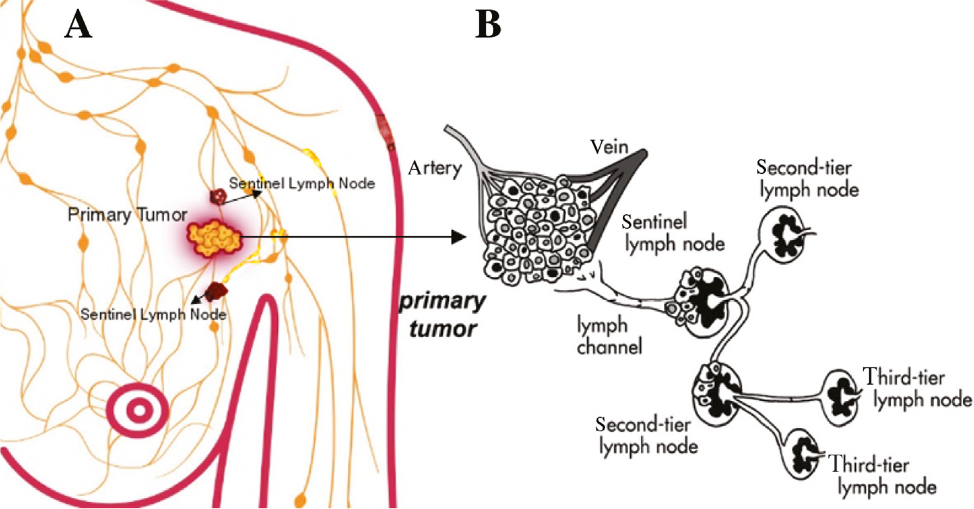 Breast sentinel lymph node biopsy with imaging towards minimally invasive surgery