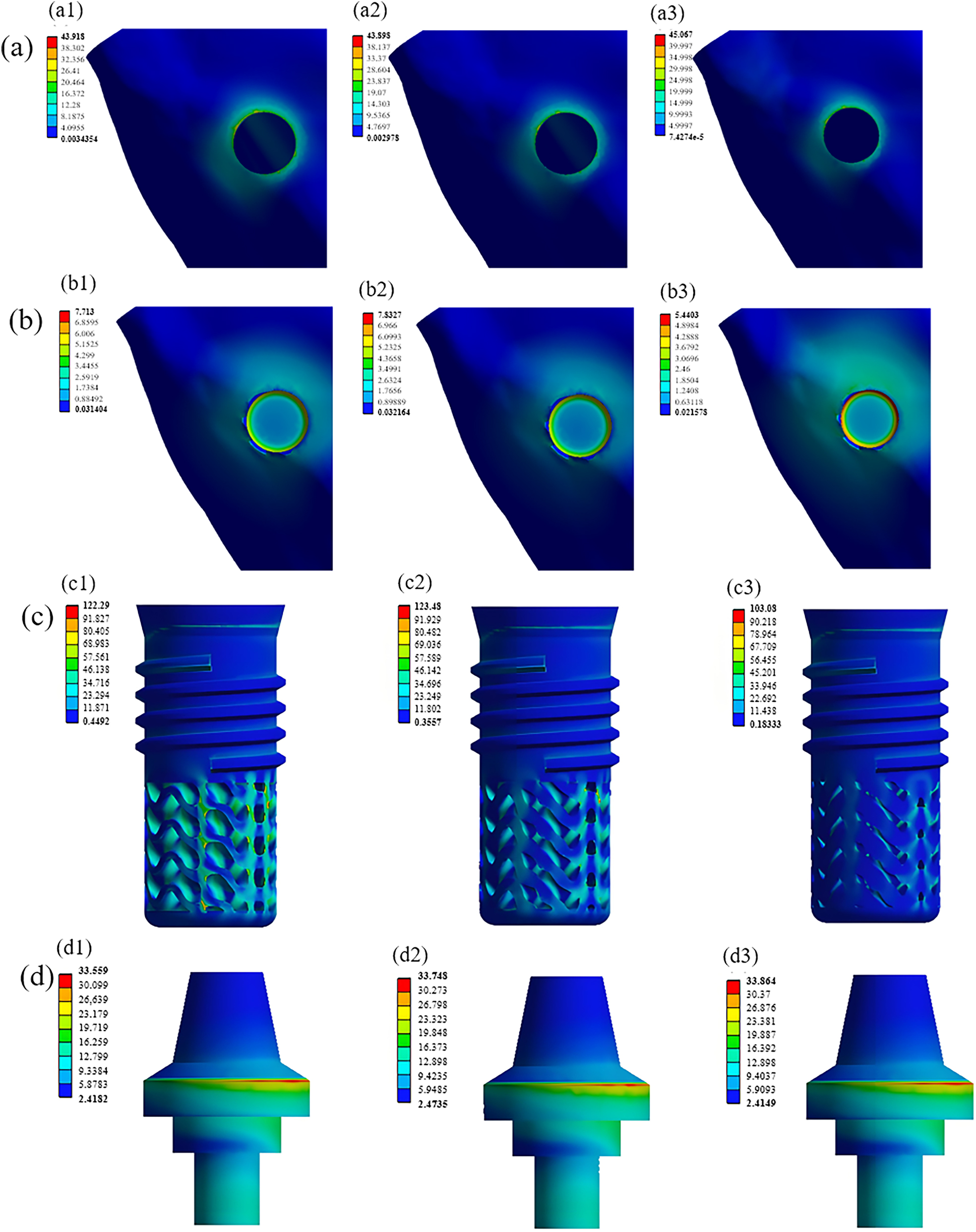 Optimized design of porous dental implant structures based on triply ...