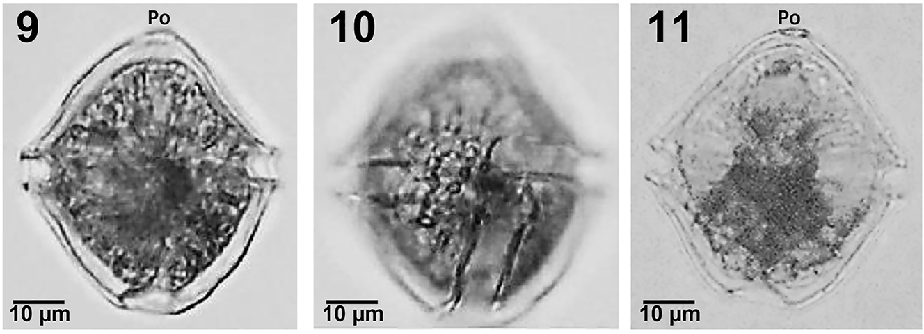 Diversity and distribution of species of the planktonic dinoflagellate ...