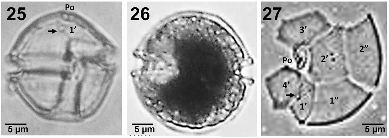 Diversity and distribution of species of the planktonic dinoflagellate ...