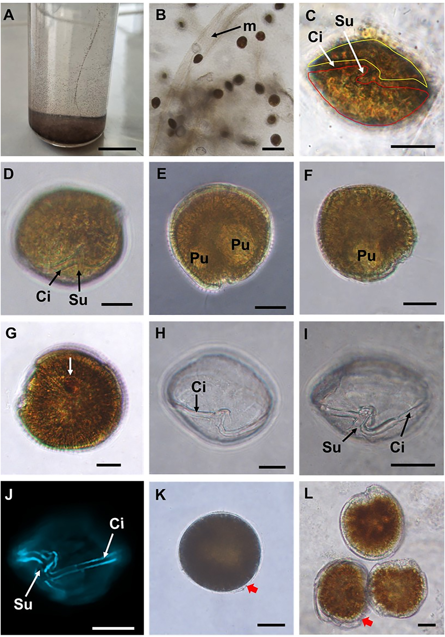 Gambierdiscus carpenteri (Dinophyceae) from Bahía de La Paz, Gulf of ...