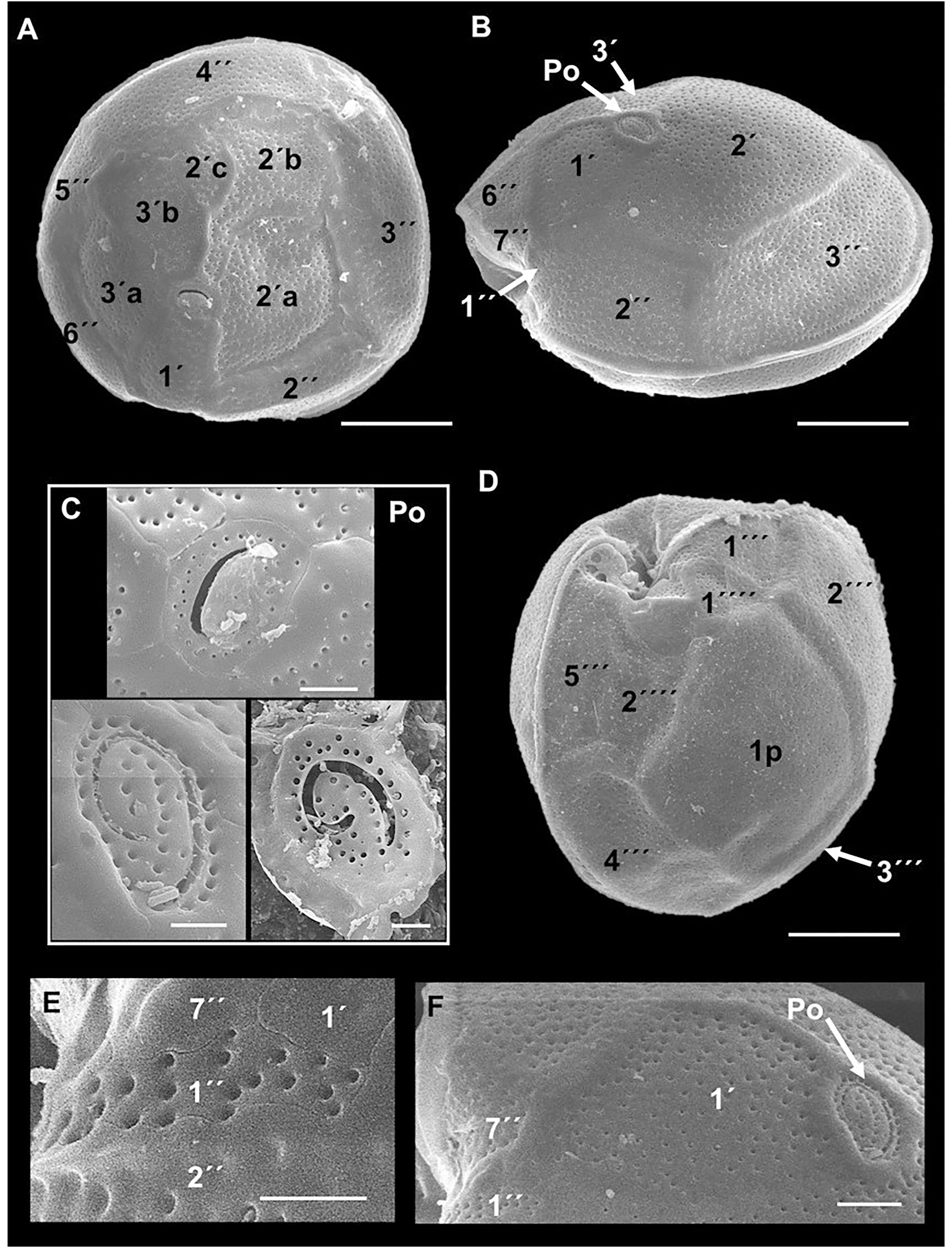 Gambierdiscus carpenteri (Dinophyceae) from Bahía de La Paz, Gulf of ...