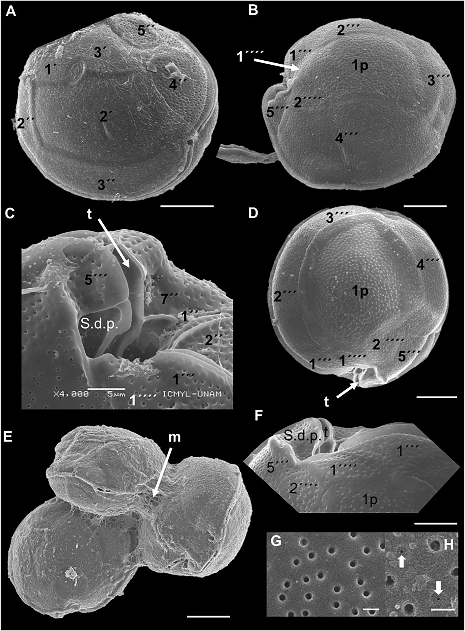 Gambierdiscus carpenteri (Dinophyceae) from Bahía de La Paz, Gulf of ...