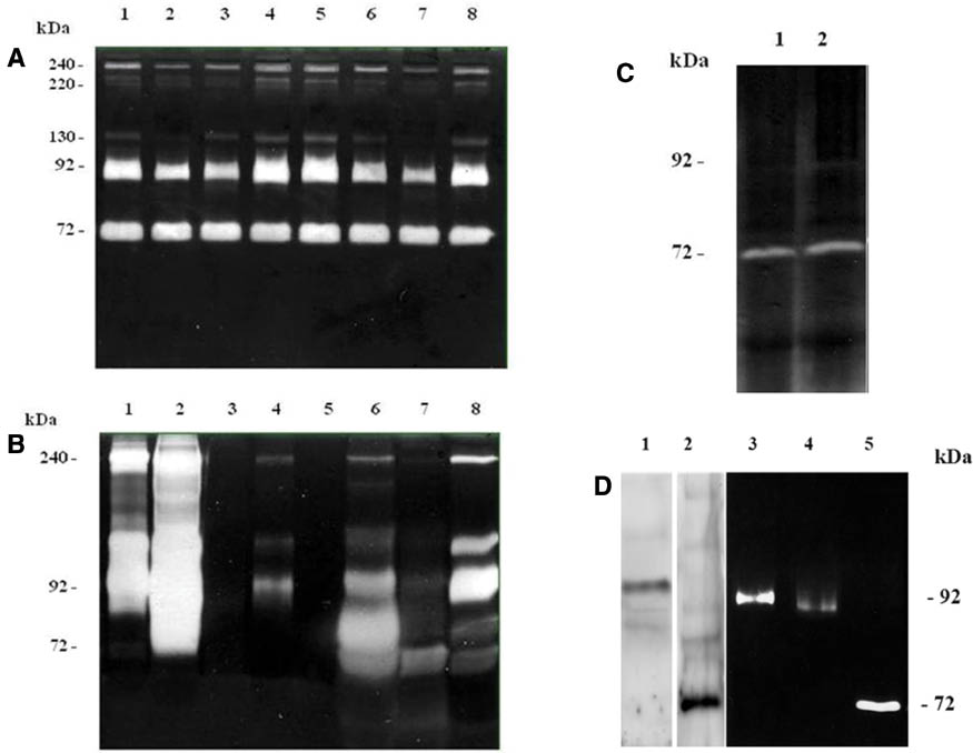 Substrate-zymography: a still worthwhile method for gelatinases ...