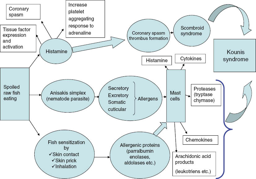 Kounis syndrome: an update on epidemiology, pathogenesis, diagnosis and ...