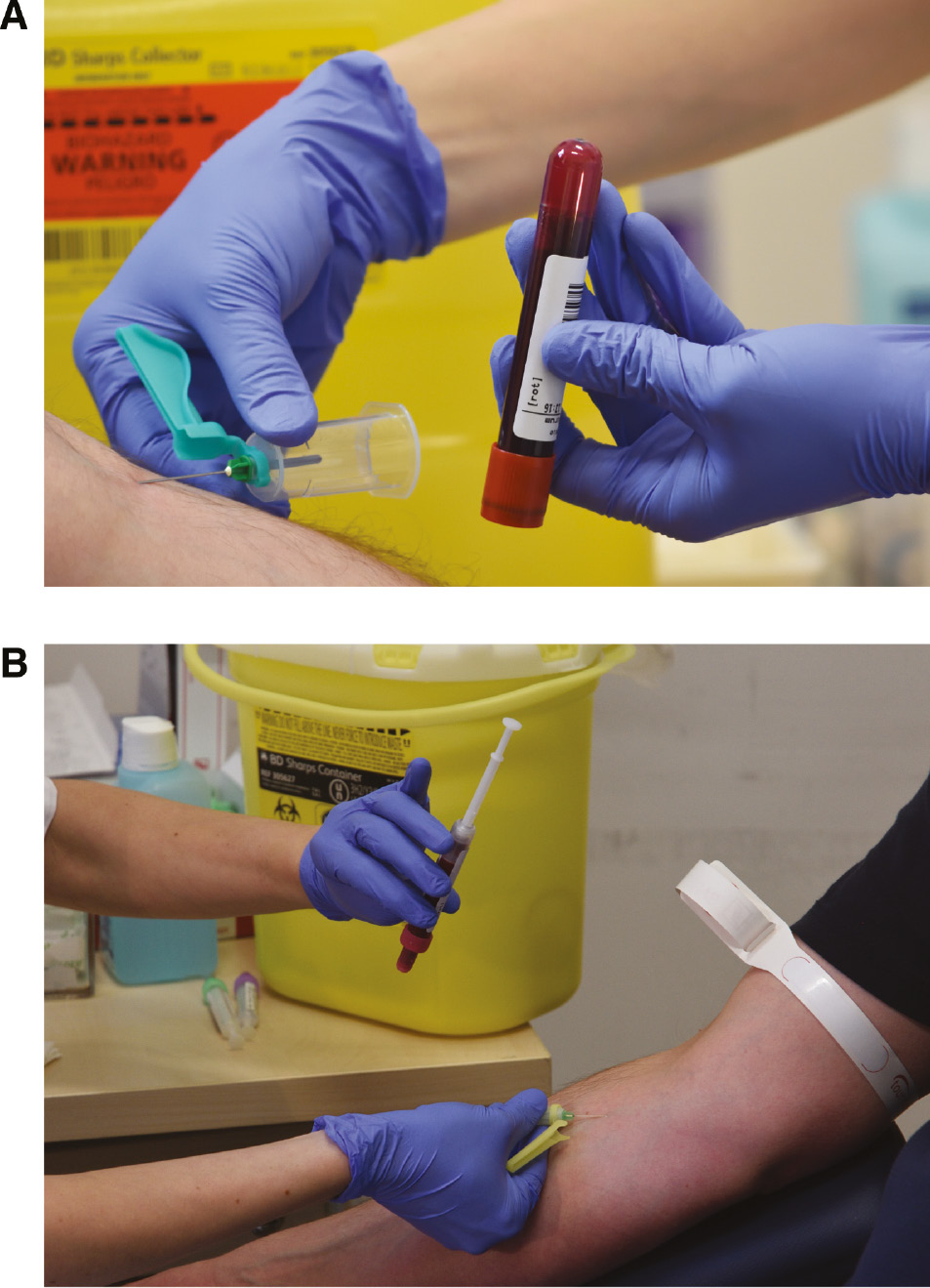 Joint EFLM-COLABIOCLI Recommendation for venous blood sampling