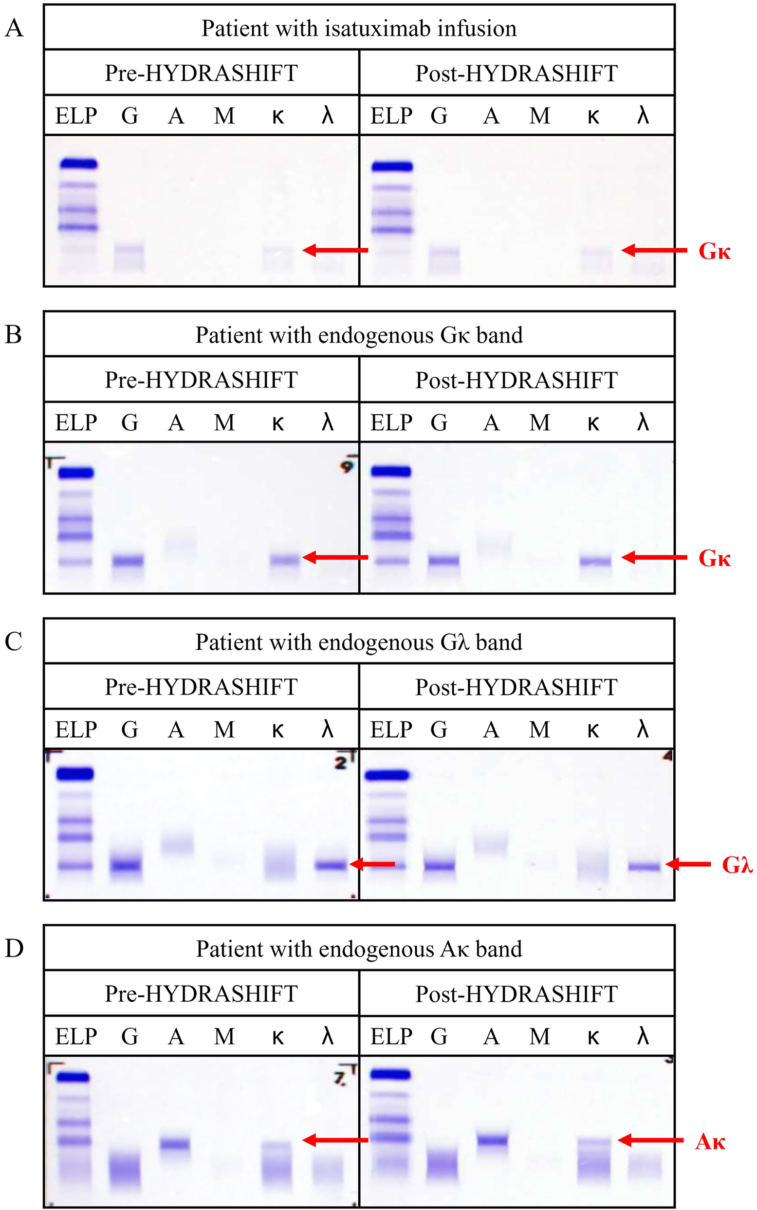 Evaluating the HYDRASHIFT 2/4 Daratumumab assay: a powerful approach to ...