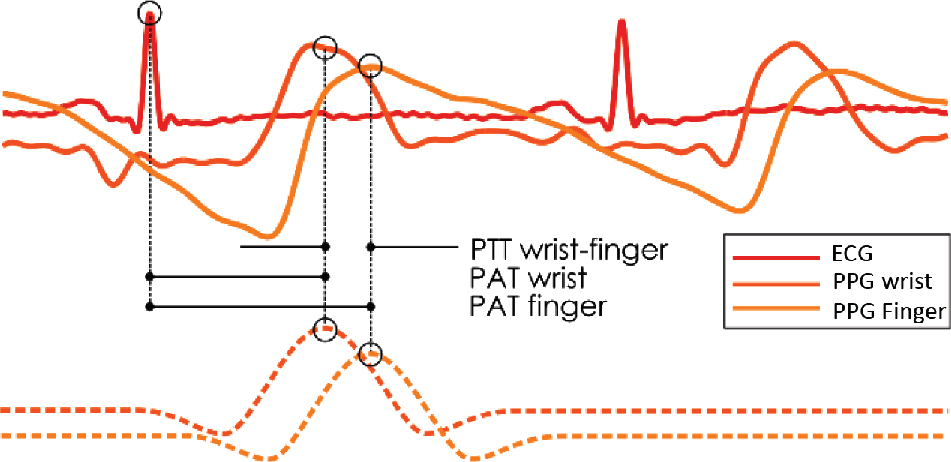 Novel computation of pulse transit time from multi-channel PPG signals ...