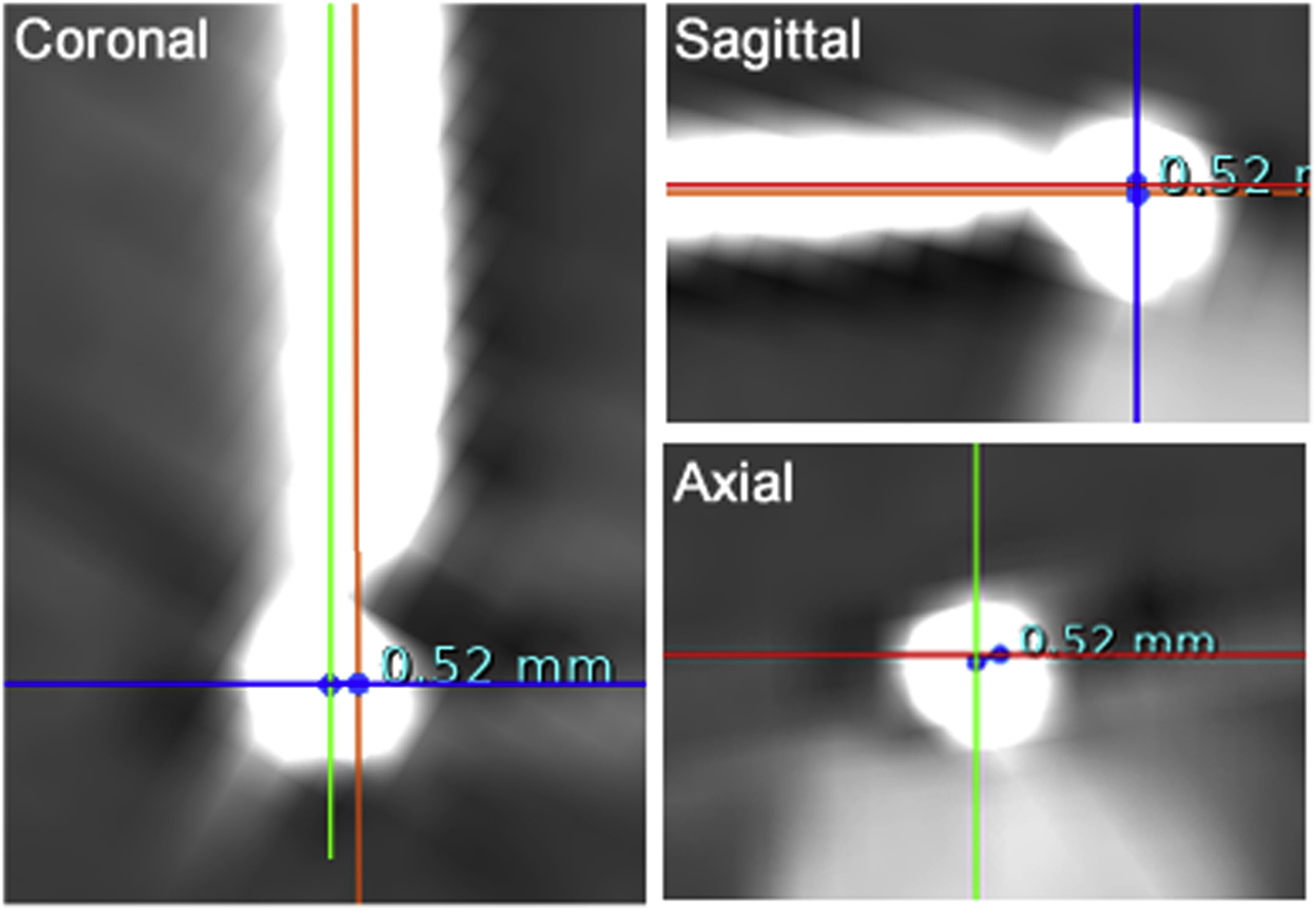 Fluoroscopy-guided robotic biopsy intervention system