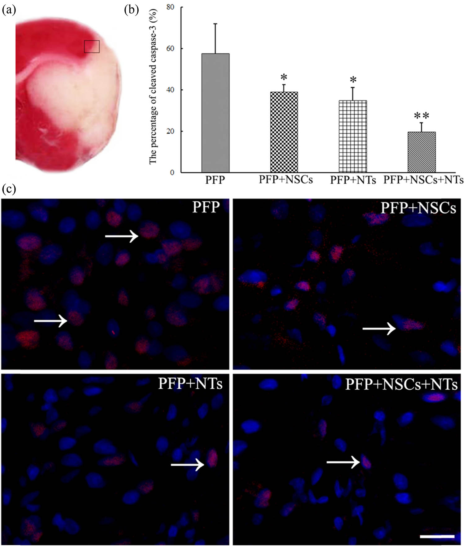 Treatment of rat brain ischemia model by NSCs-polymer scaffold ...