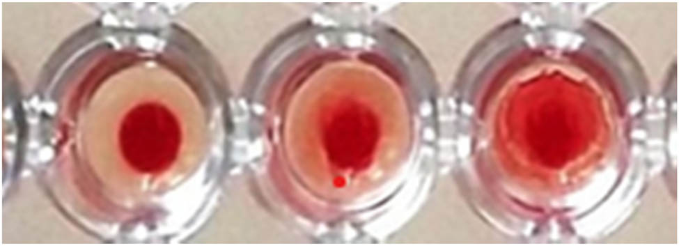 An automated reading of semi-quantitative hemagglutinatio...