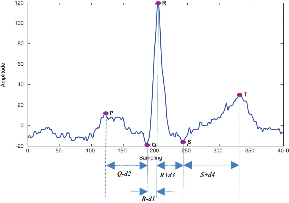 Design of a web laboratory interface for ECG signal analysis using MATLAB builder NE