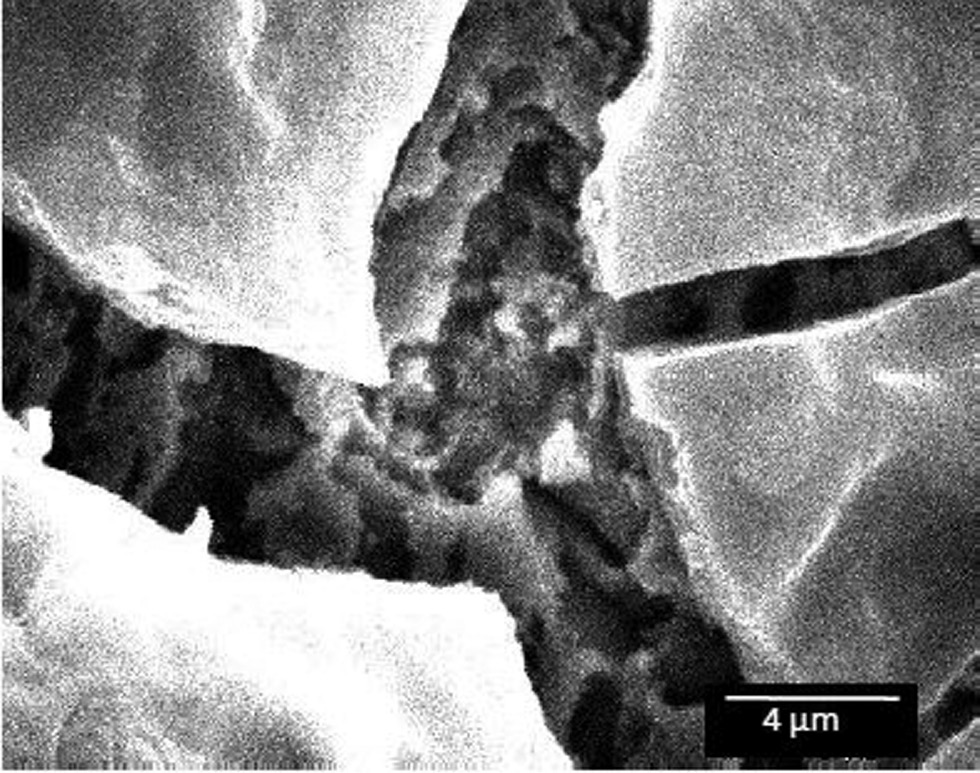 Corrosion of copper intrauterine devices: review and recent developments