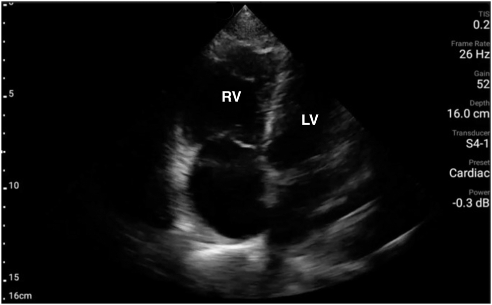 Utilization of point-of-care ultrasound and rotational ...