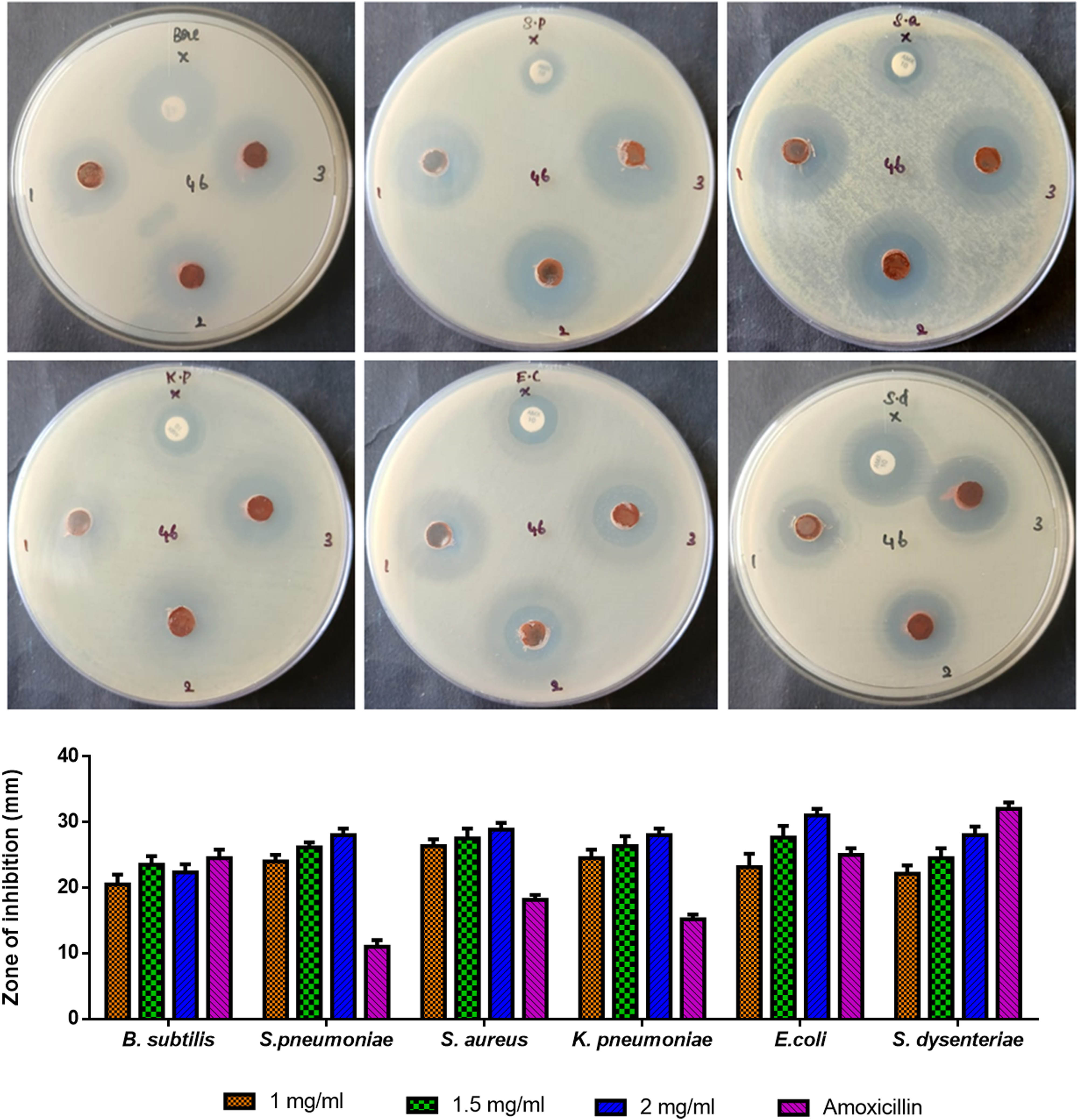 A study of the anticancer potential of Pluronic F-127 encapsulated ...