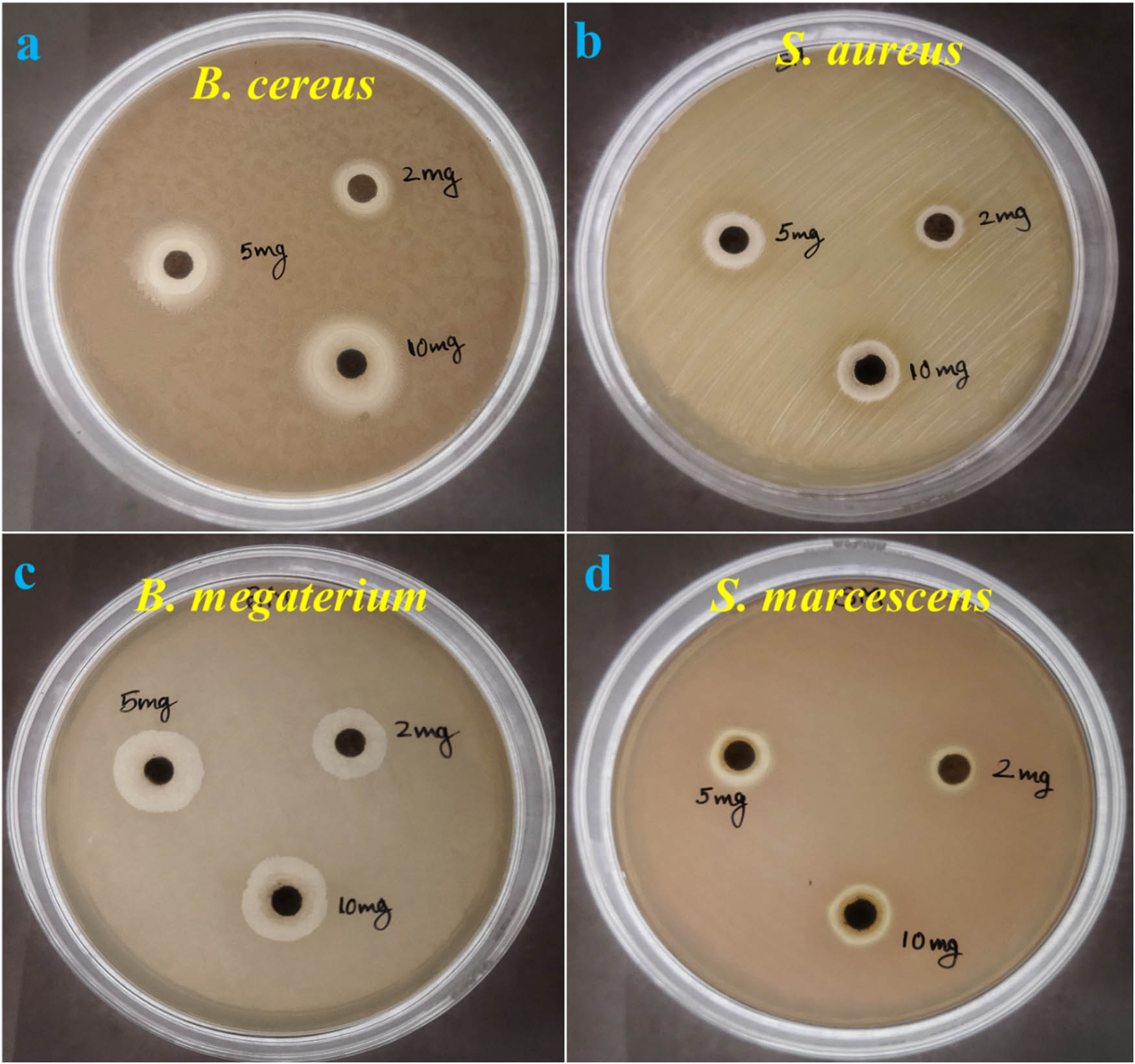 Assessment of antimicrobial activity and methyl orange dye removal by ...