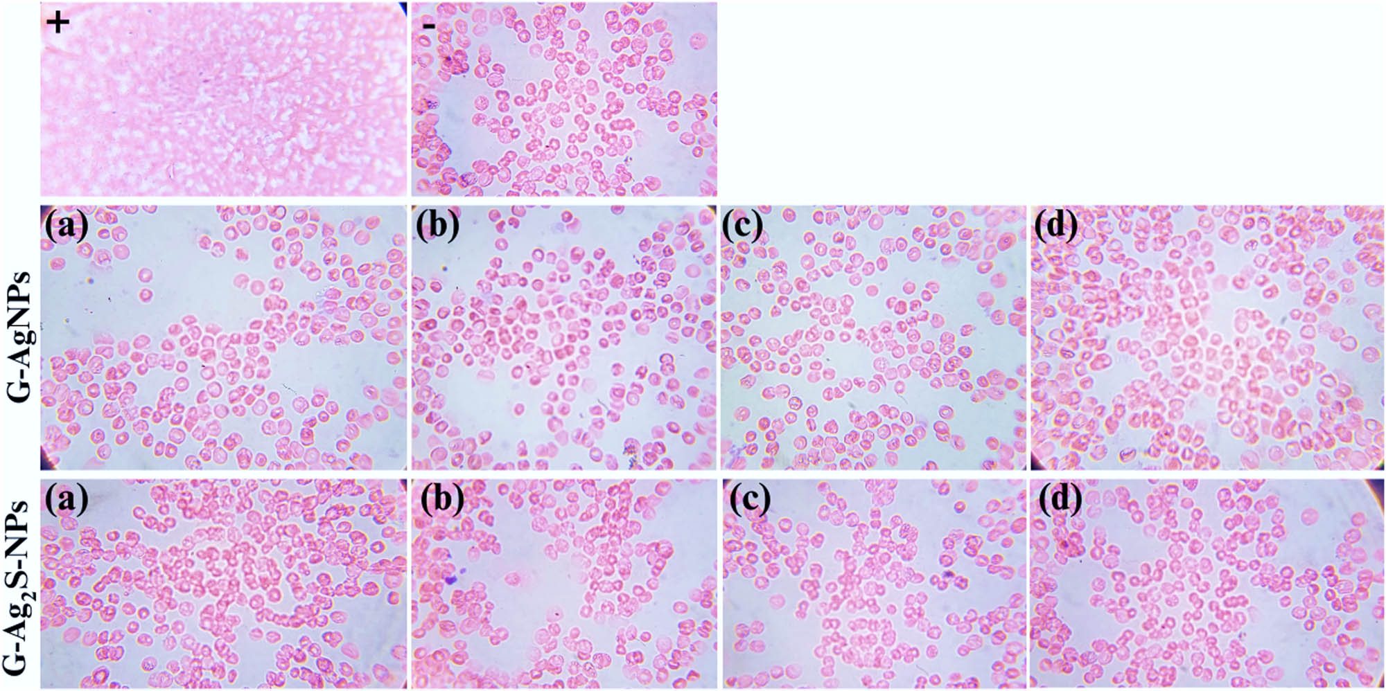A comparative study of Fagonia arabica fabricated silver sulfide ...
