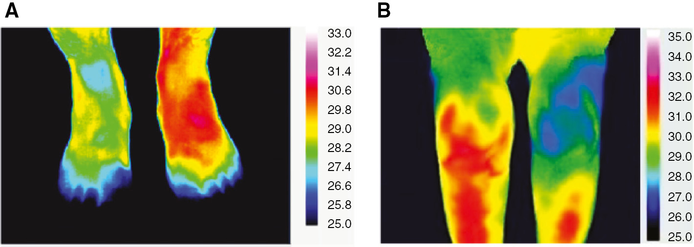 Clinical assessment of arthritic knee pain by infrared th...