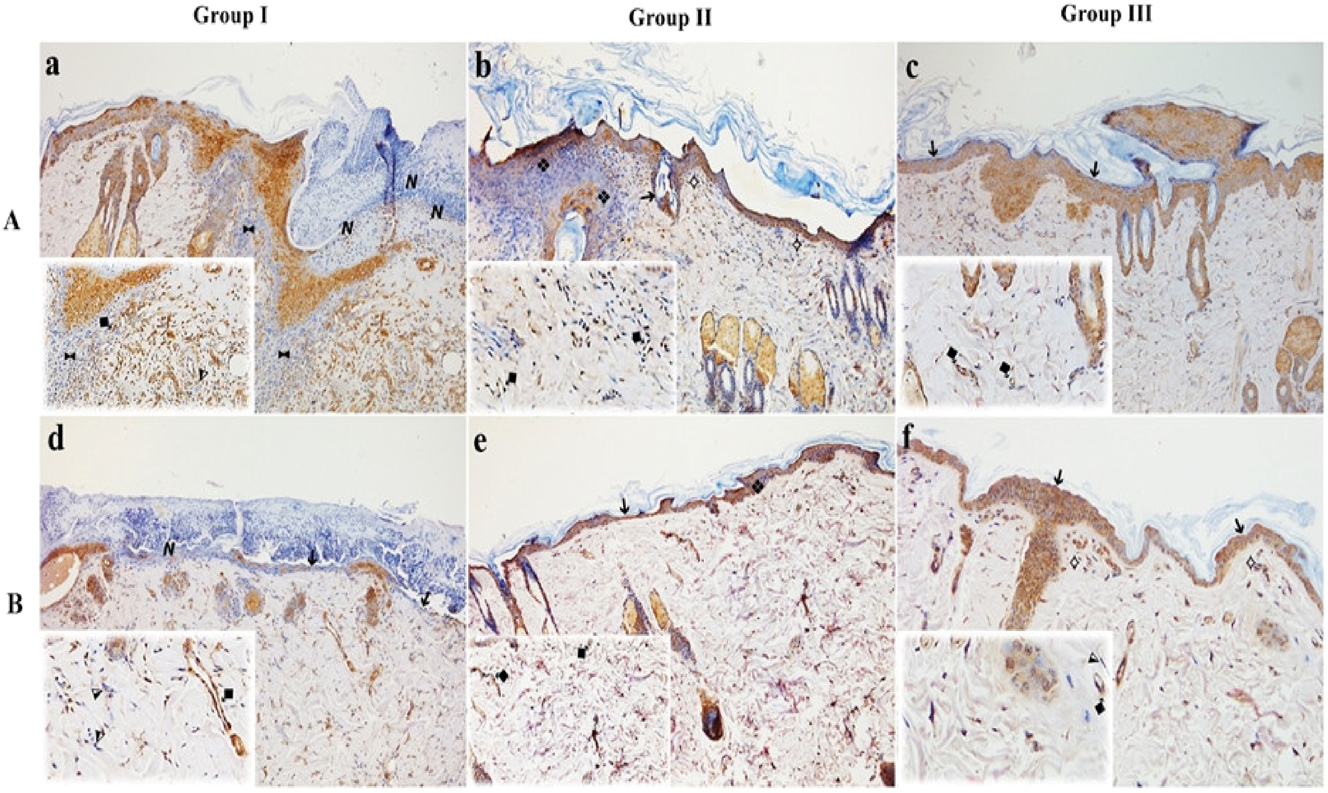 Investigating the therapeutic potential of medical leech ...