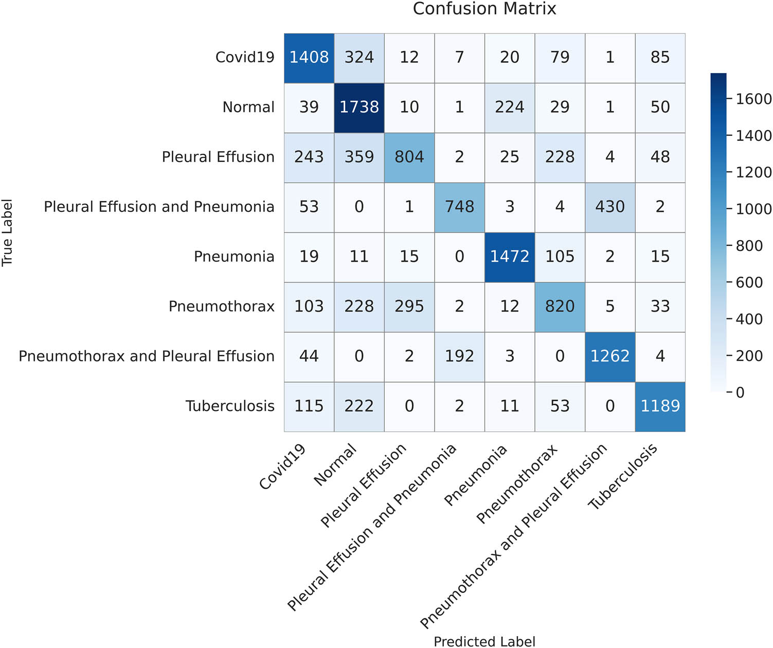 Detection of single and dual pulmonary diseases using an optimized ...