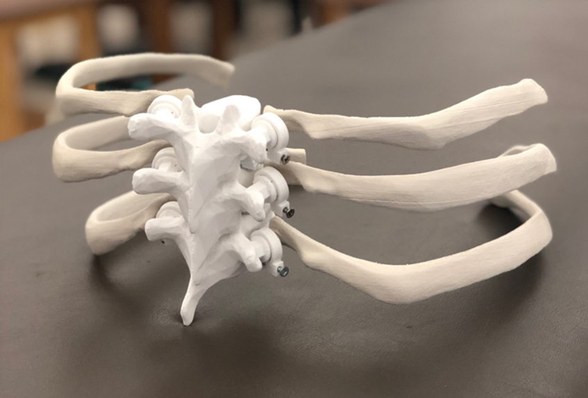 The use of 3D printing for osteopathic medical education of rib disorders