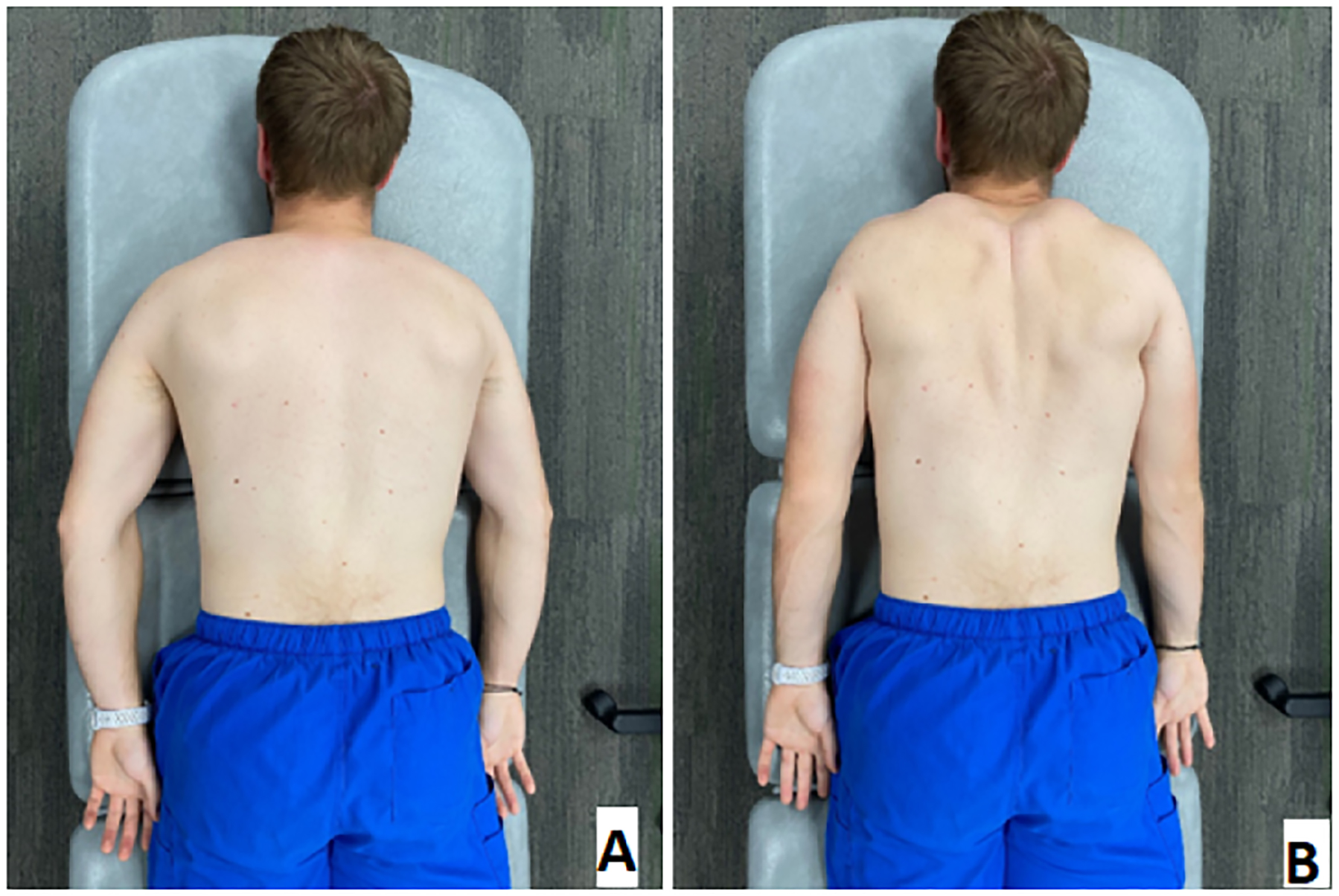 Quantitative ultrasound to assess efficacy of treatment f...
