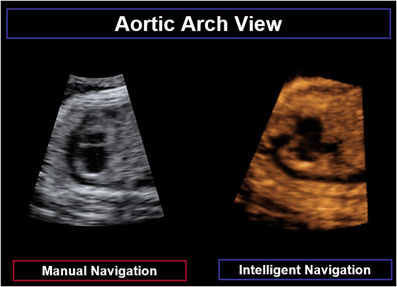 Fetal intelligent navigation echocardiography (FINE) has superior ...