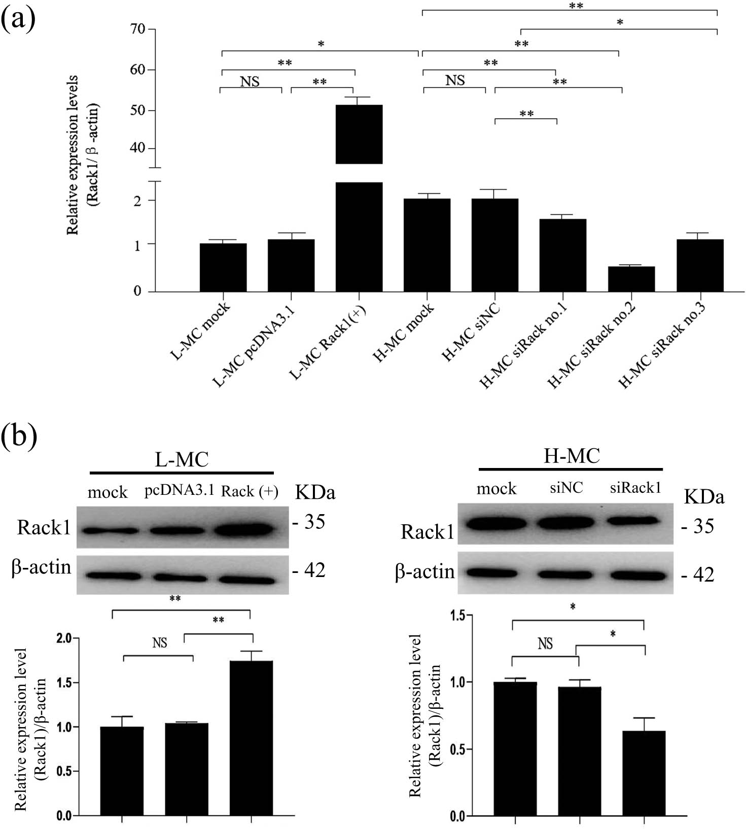 Rack1 regulates pro-inflammatory cytokines by NF-κB in di...