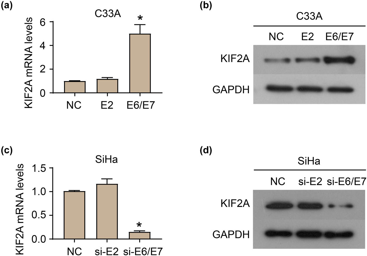 HPV16 E6E7 up-regulates KIF2A expression by activating JN...