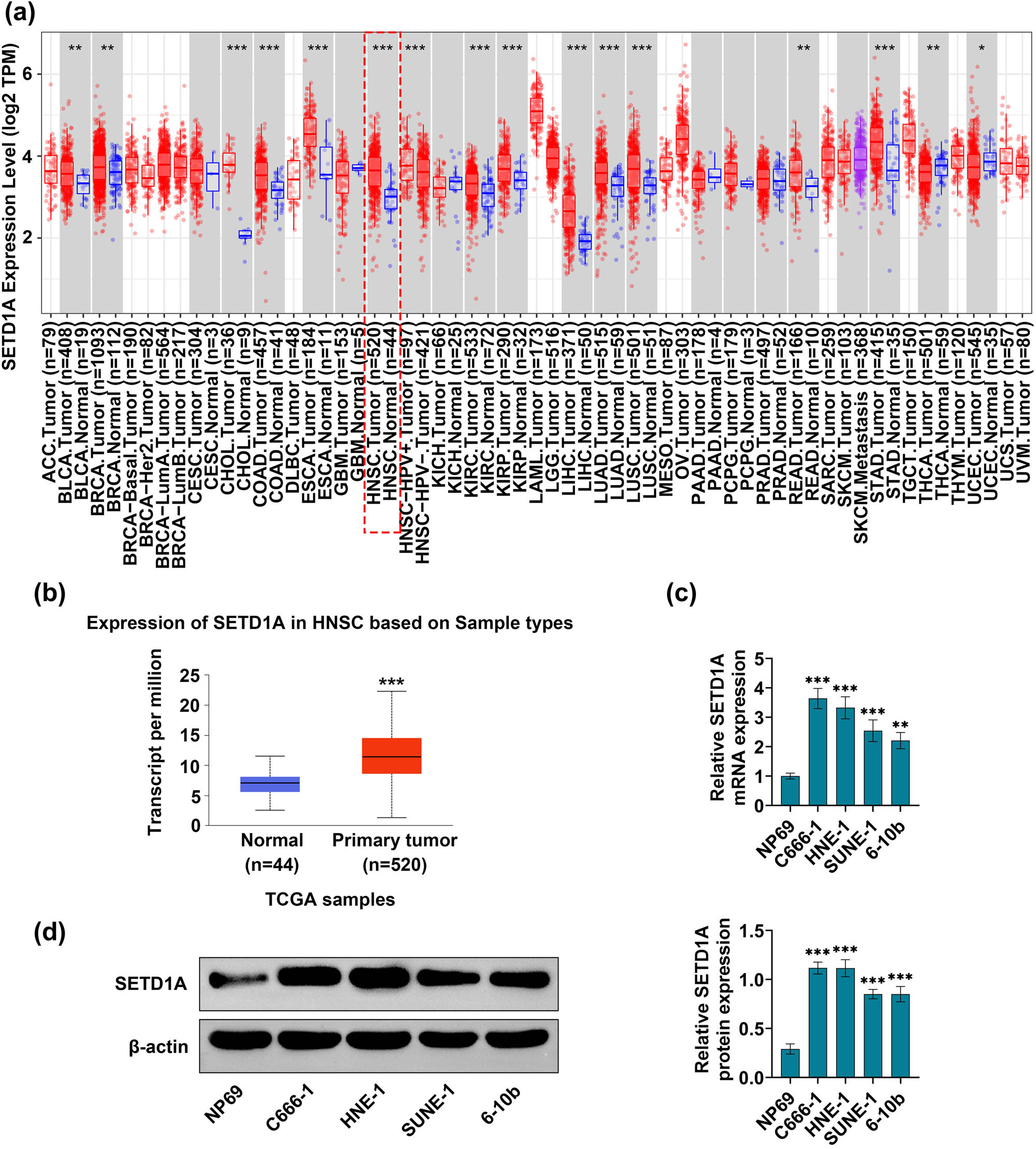 SETD1A promotes the proliferation and glycolysis of nasopharyngeal ...