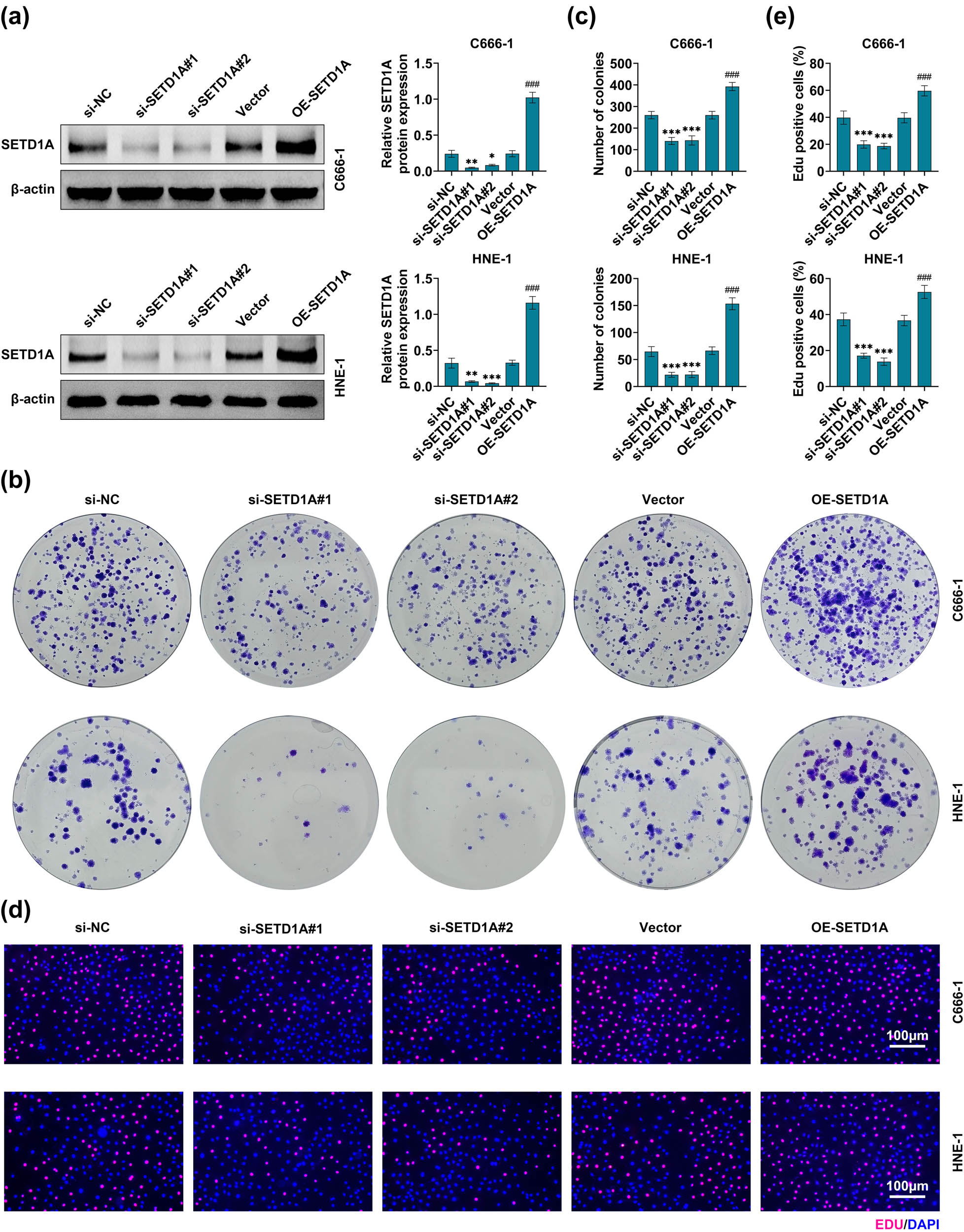 SETD1A promotes the proliferation and glycolysis of nasopharyngeal ...