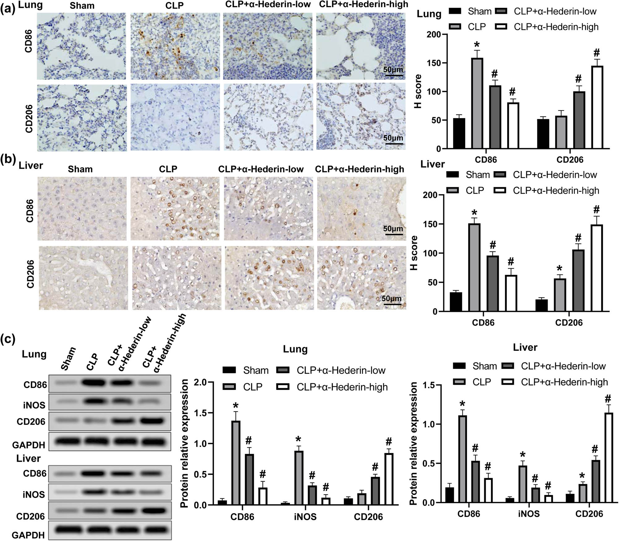 α-Hederin regulates macrophage polarization to relieve sepsis-induced ...
